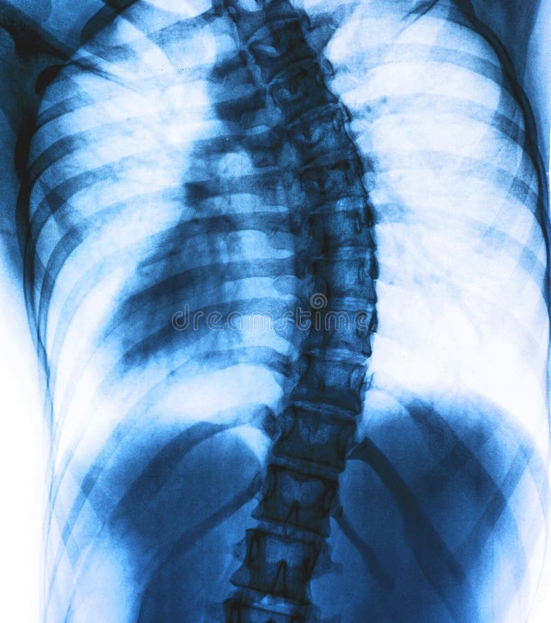 X-Ray scan human stock photo. Image of skeleton, healthcare - 42767990
