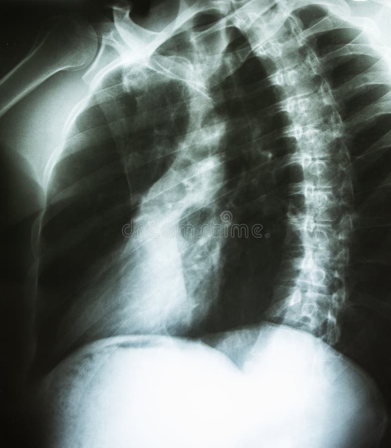 X-Ray scan human stock photo. Image of medical, healthcare - 44299080