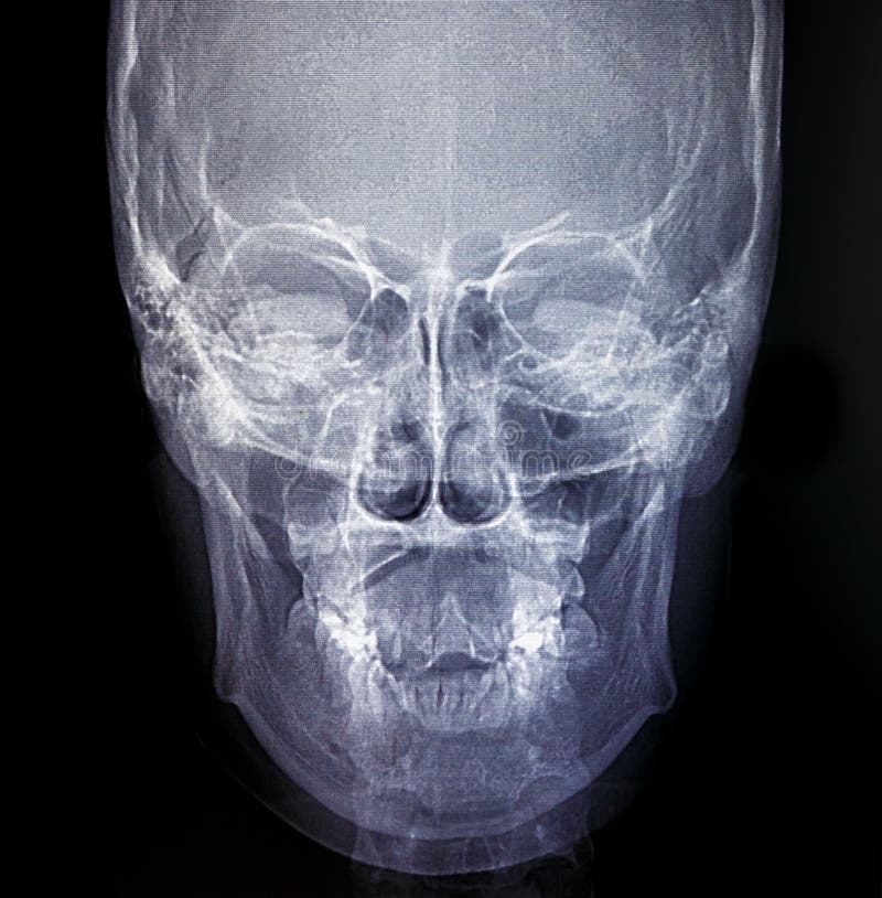 Scan the human body stock image. Image of process, hernia - 34804511