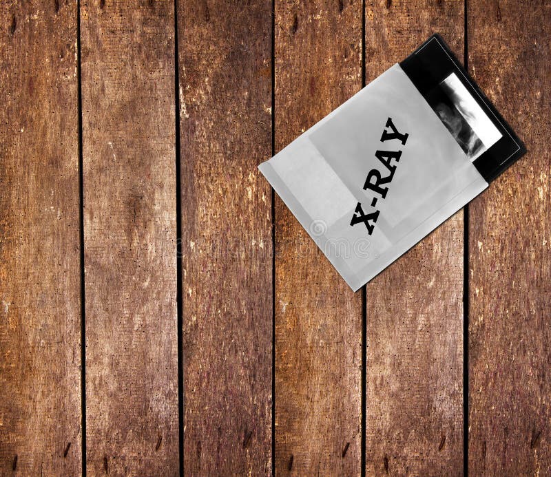 X-Ray scan on table stock image. Image of workplace - 109211015