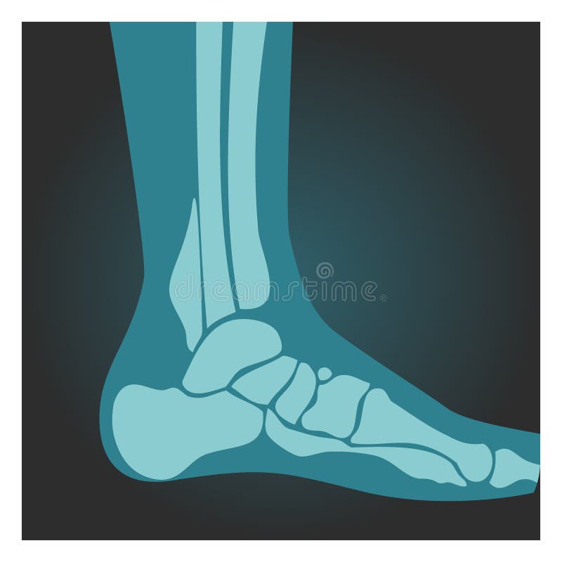 Bones of the Human Foot stock vector. Illustration of xray - 21352900