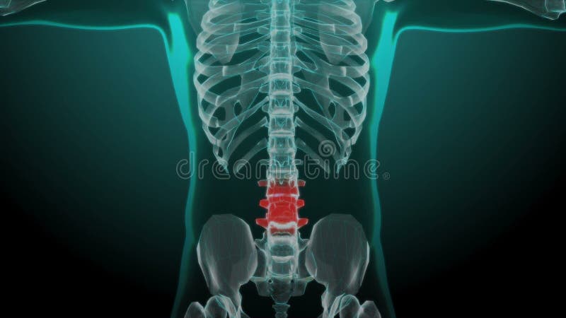 Spine Pain. Blue Human Anatomy Body 3D Scan Render on Blue Background ...