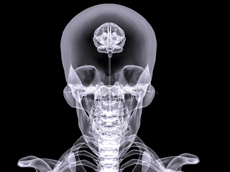 X-ray small brain stock illustration. Illustration of smart - 41056499