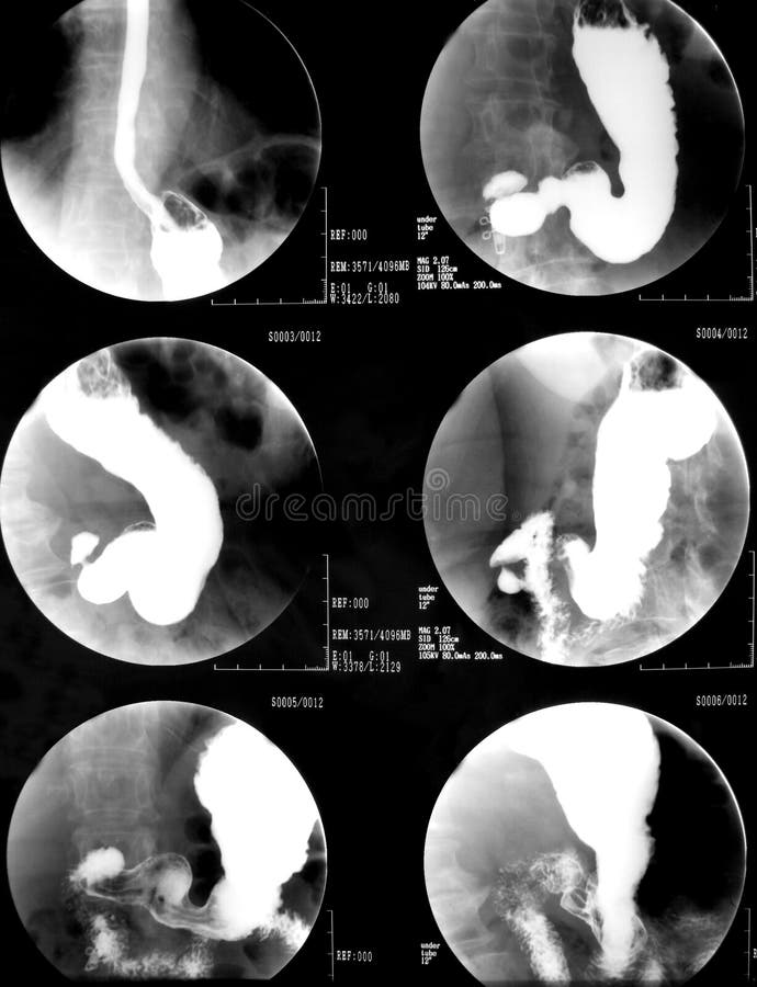 5,968 Stomach Anatomy Stock Photos - Free & Royalty-Free Stock Photos ...