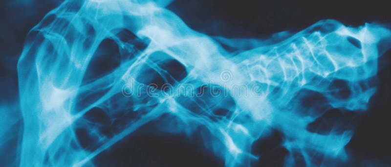 X-ray Texture Revealing Intricate Details and Depth in a Vibrant Blue Background Stock ...