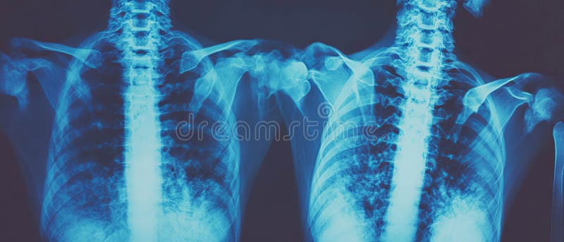 X-ray Texture Showcasing a Uniform and Consistent Repeating Pattern in ...