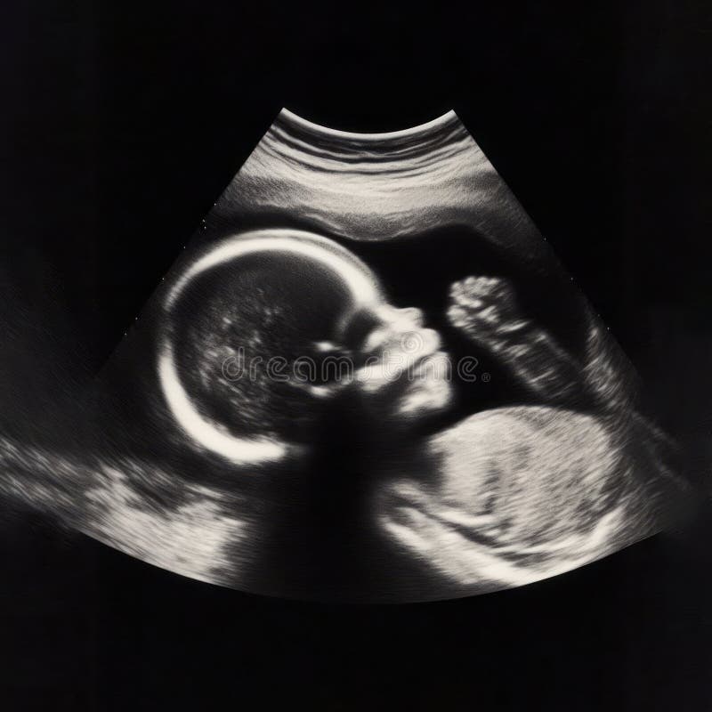 X Ray Ultrasound Baby Image. Ai Generative Stock Illustration ...