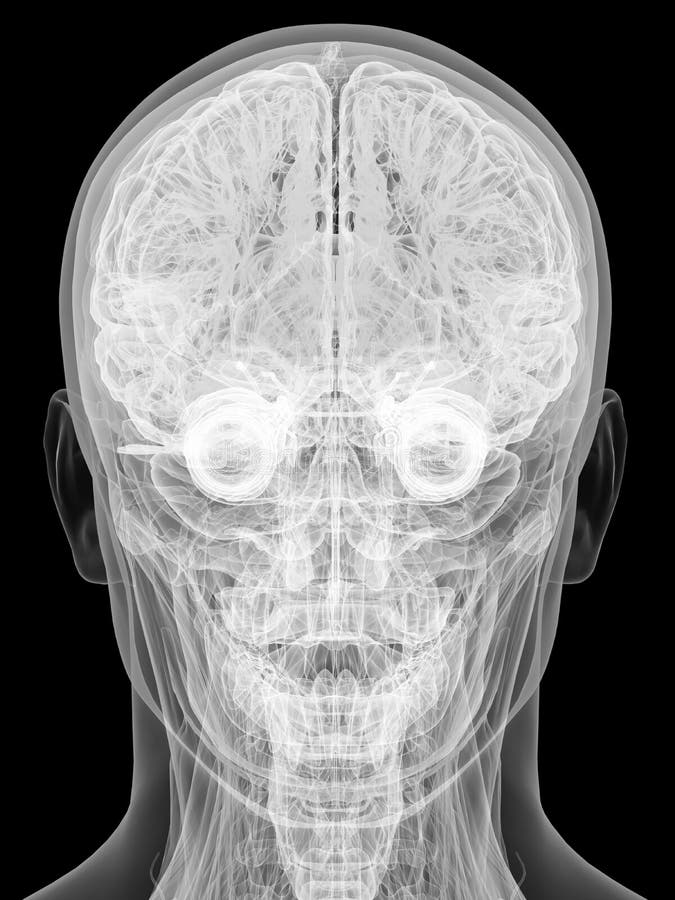 93+ X ray human head Free Stock Photos - StockFreeImages
