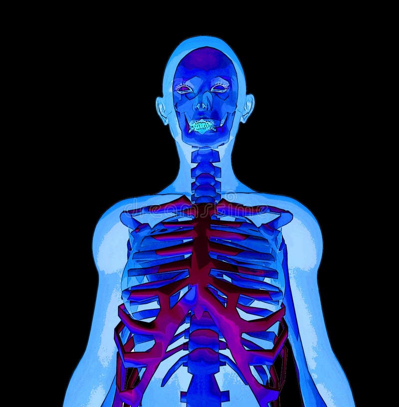 Os 2 de rayon X image stock. Image du tête, patient, actif - 3319193