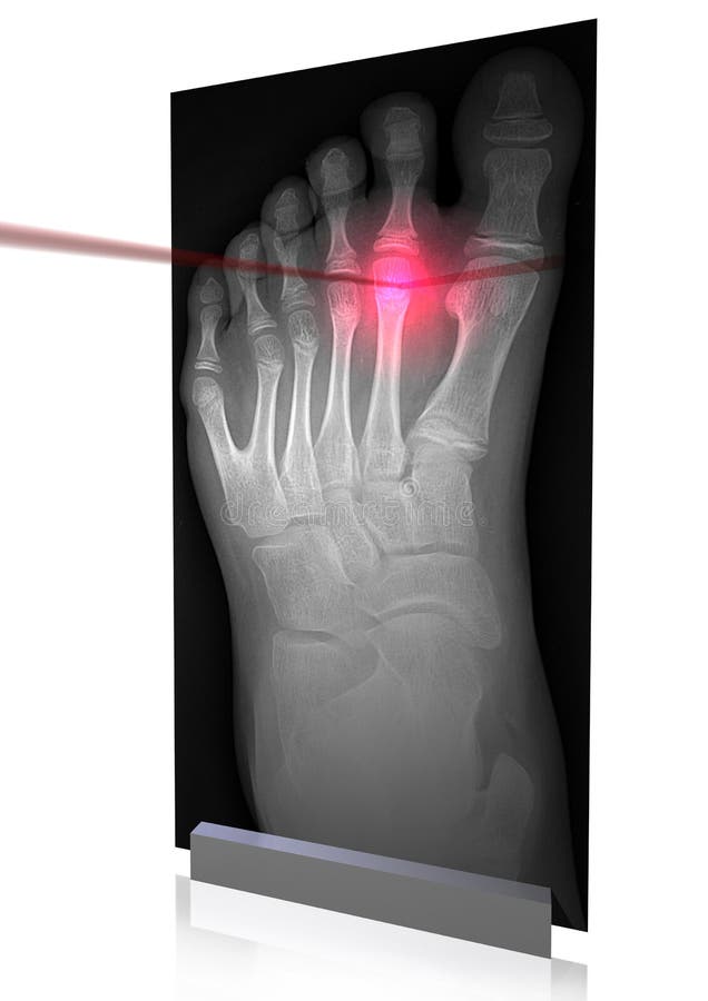 X-rays-4 stock illustration. Illustration of patient - 18457616