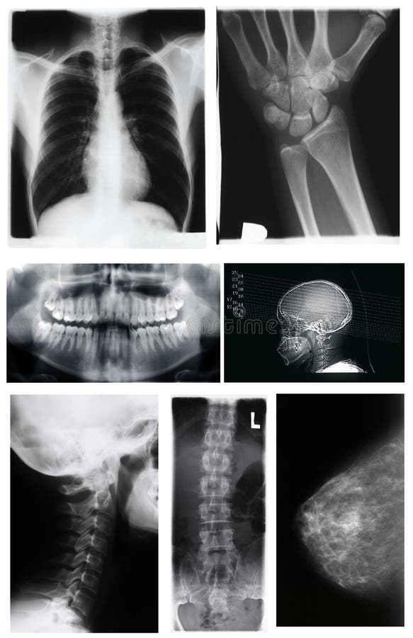 X rays collection stock image. Image of examination, surgery - 12837881