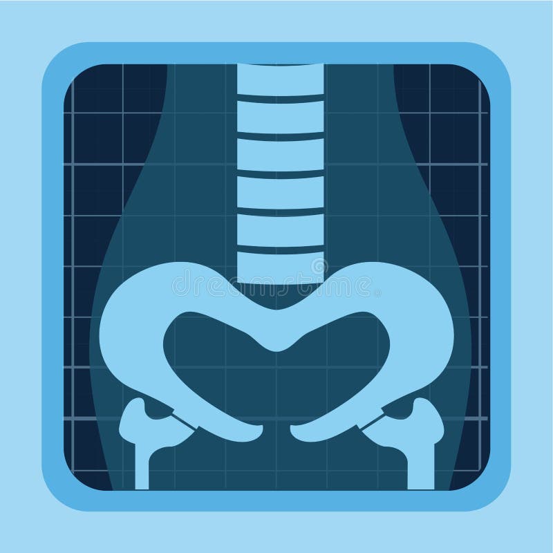 X rays design stock vector. Illustration of isolated - 46030258