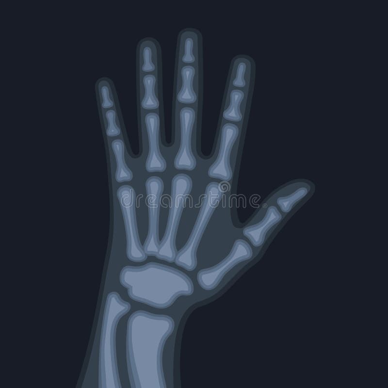 X Rays Style Human Hand. Vector Stock Vector - Illustration of black ...
