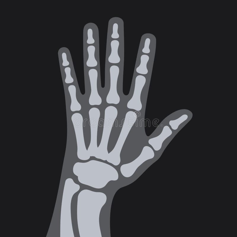 X Rays Style Human Hand. Vector Stock Vector - Illustration of ...