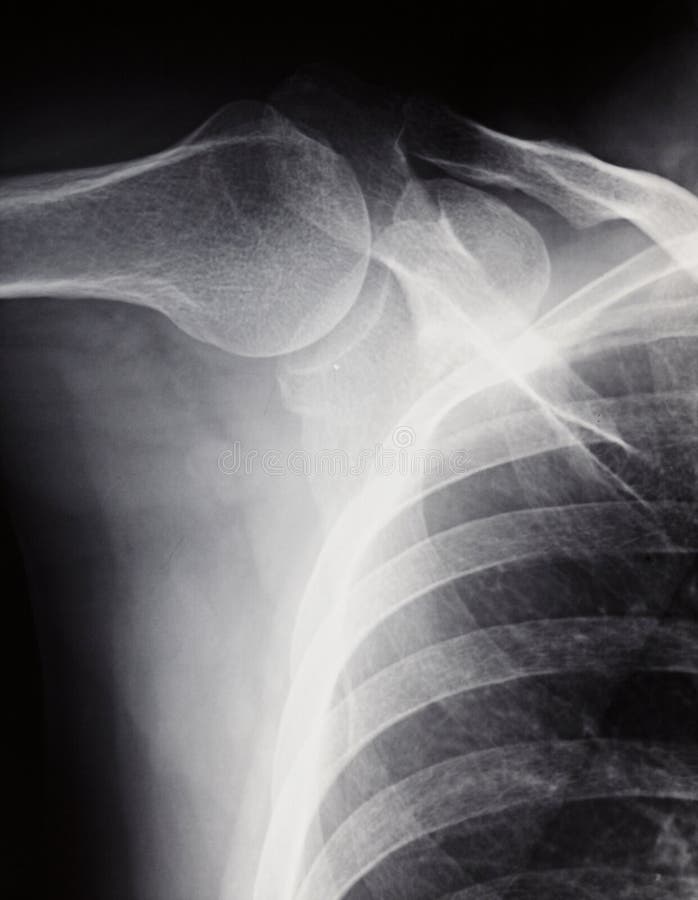 Xray 03 stock photo. Image of body, nurse, bone, medic - 3622992