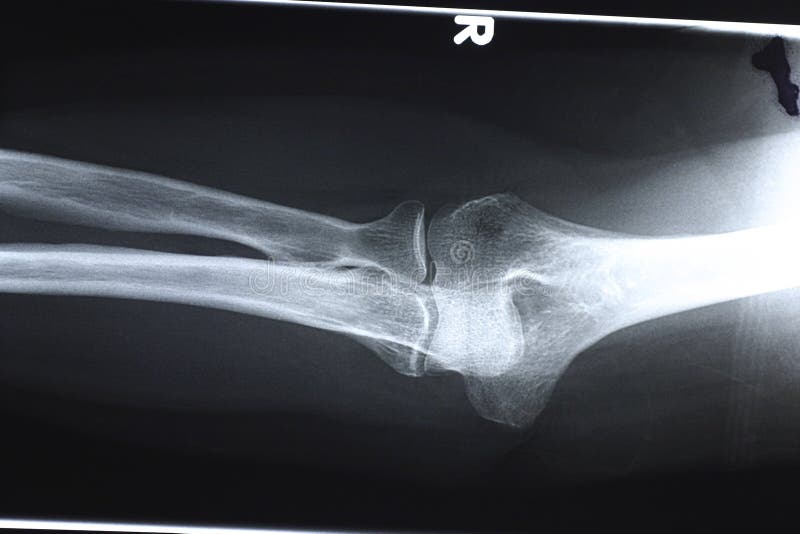 389 Human Anatomy Front View Body Stock Photos - Free & Royalty-Free ...