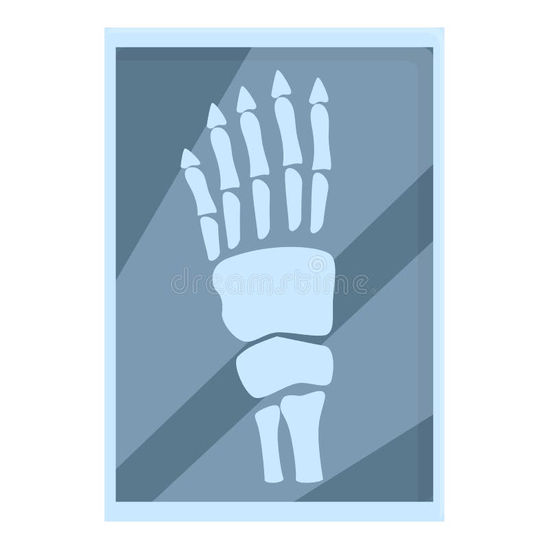 Xray Hand Scan Icon Cartoon Vector. Bone Test Stock Vector ... Xray Hand Scan Icon Cartoon Vector. Bone Test Stock Vector ...