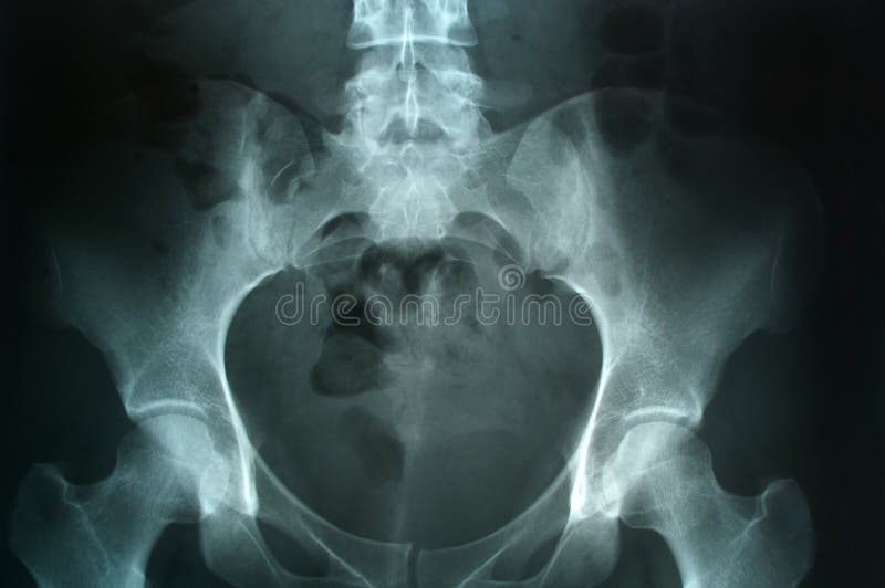 Female Pelvis . Reproduction System Anatomy Stock Image - Image of ...