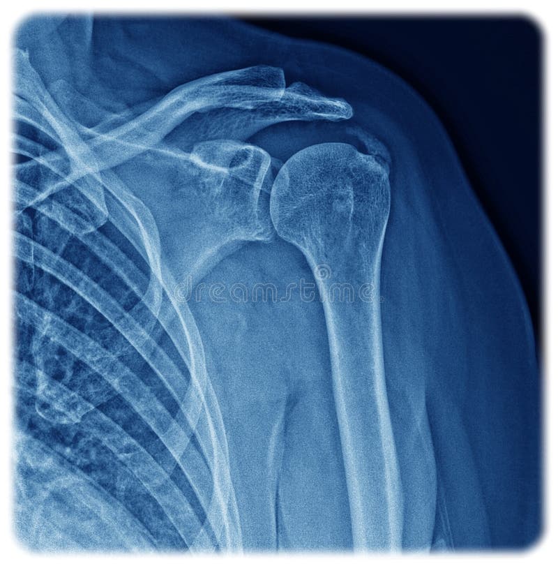 Skull xray stock photo. Image of examination, skeleton - 19001360