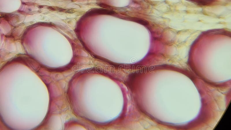 Xylem on Beet Root Preparation Under a Microscope Stock Image - Image ...