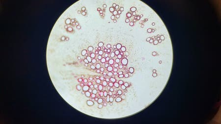 Xylem and Other Tissues of Beet Root Under a Microscope Stock Image ...