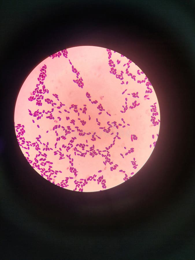 Saccharomyces Cerevisiae Under Light Microscope
