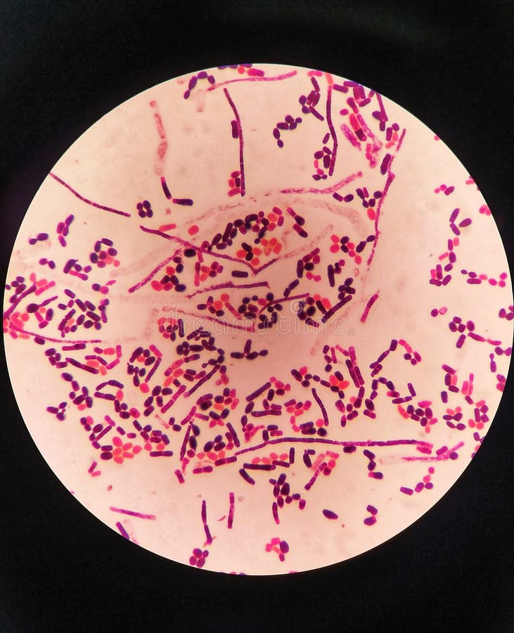 Yeast Cells and Hyphae in Gram Stain Fine with Microscope. Stock Photo ...