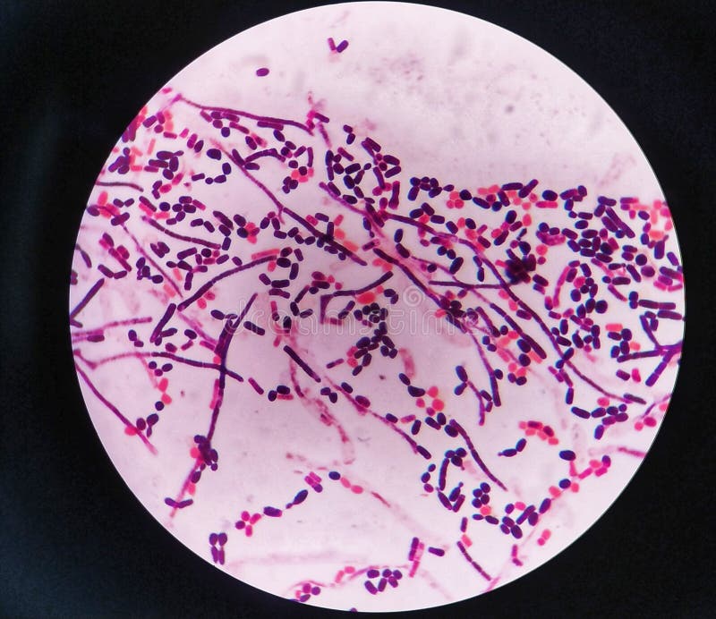 Yeast Cells And Hyphae In Gram Stain Fine With Microscope Stock Image Image Of Attack