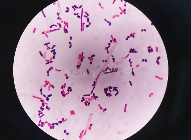 Yeast Cells and Hyphae in Gram Stain Fine with Microscope. Stock Photo ...