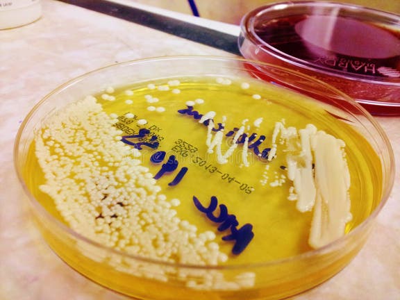 Yeast Colonies Growing on Sabouraud Dextrose Agar Stock Photo - Image ...