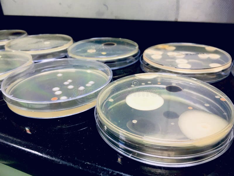 Microorganisms Were Grown in a Plate of Agar Medium. Stock Photo ...
