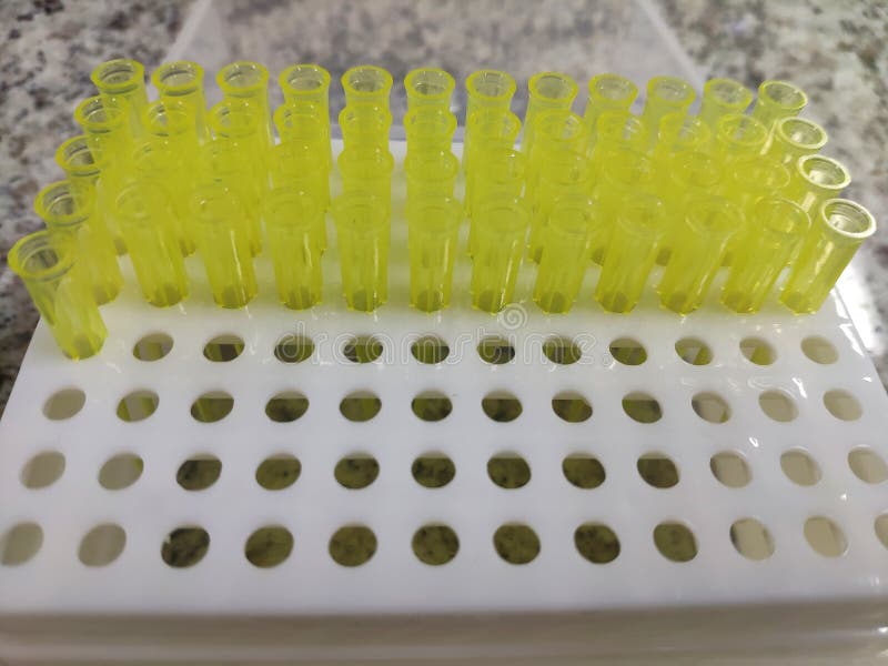 Micropipette Tips, Laboratory Inputs Stock Photo - Image of ponteiras ...