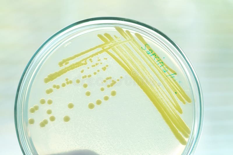 10,188 Yellow Bacteria Photos - Free & Royalty-Free Stock Photos from ...