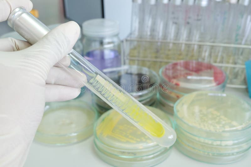 Yellow Colony of bacteria stock photo. Image of agar - 93206530