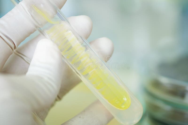 Yellow Colony of bacteria stock photo. Image of agar - 93206784