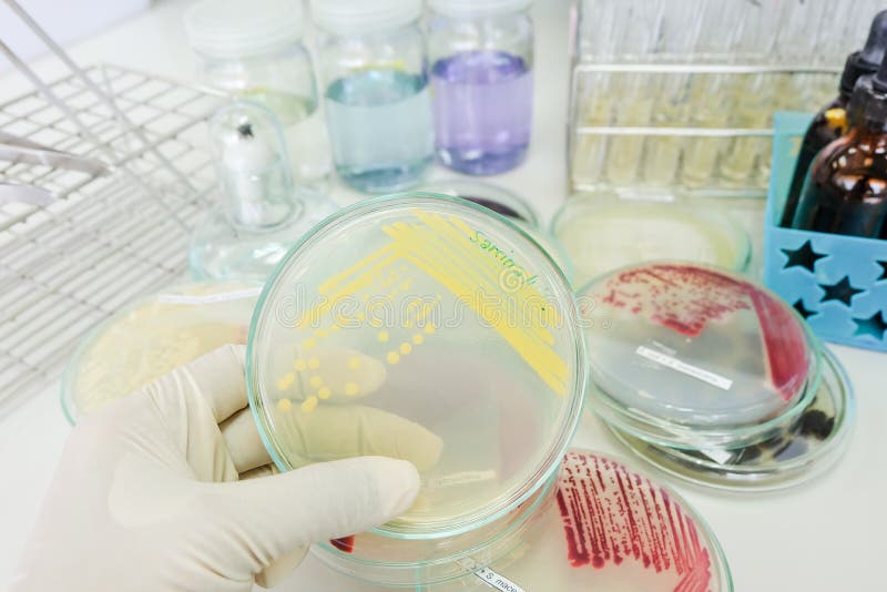 Yellow colony of bacteria stock photo. Image of microbiology - 93207082