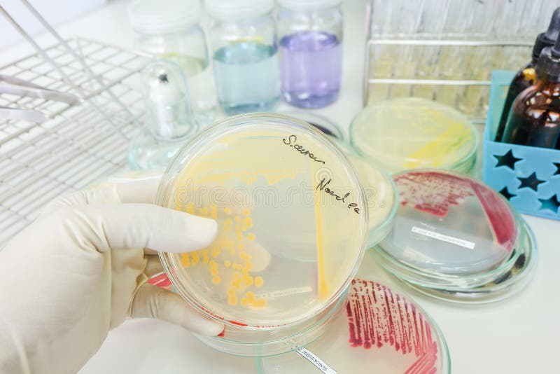 Yellow colony stock photo. Image of medicine, laboratory - 93206240