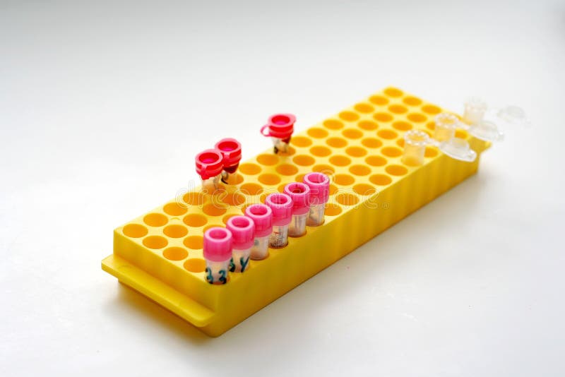 Yellow Holder of Test Tubes for Biological Liquids Stock Image - Image ...