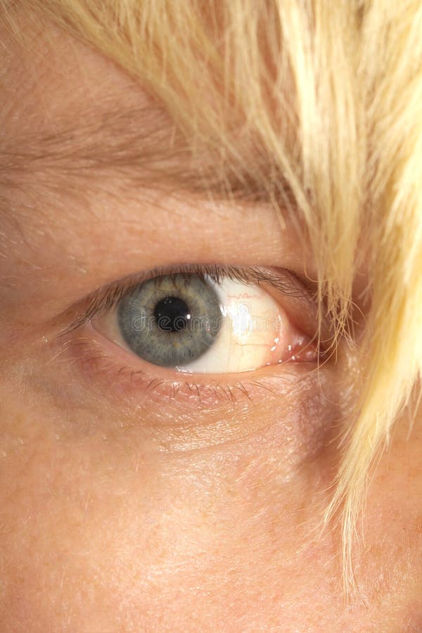 Yellow Lock of Hair on the Eye Stock Photo - Image of color, healthy ...