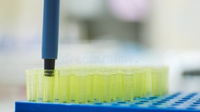 Yellow Pipette Tip in Blue Box Stock Photo - Image of chemical ...