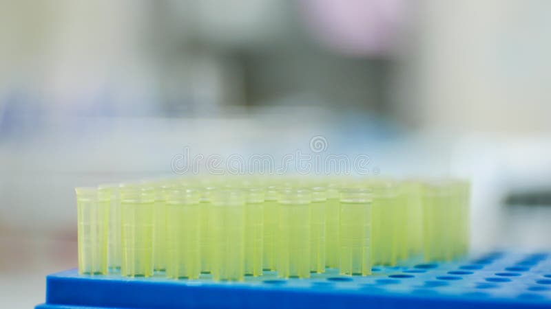 Yellow Pipette Tip in Blue Box Stock Photo - Image of closeup ...