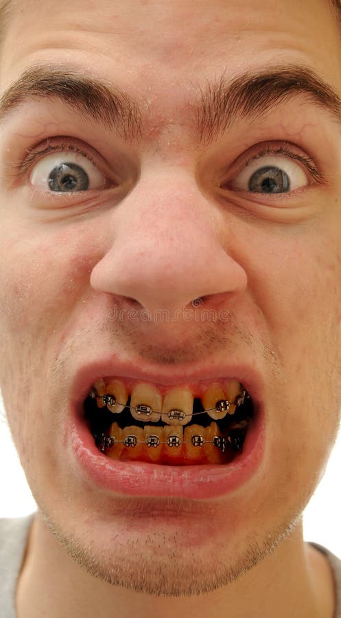 Yellow Teeth stock image. Image of acne, care, teeth - 11658263