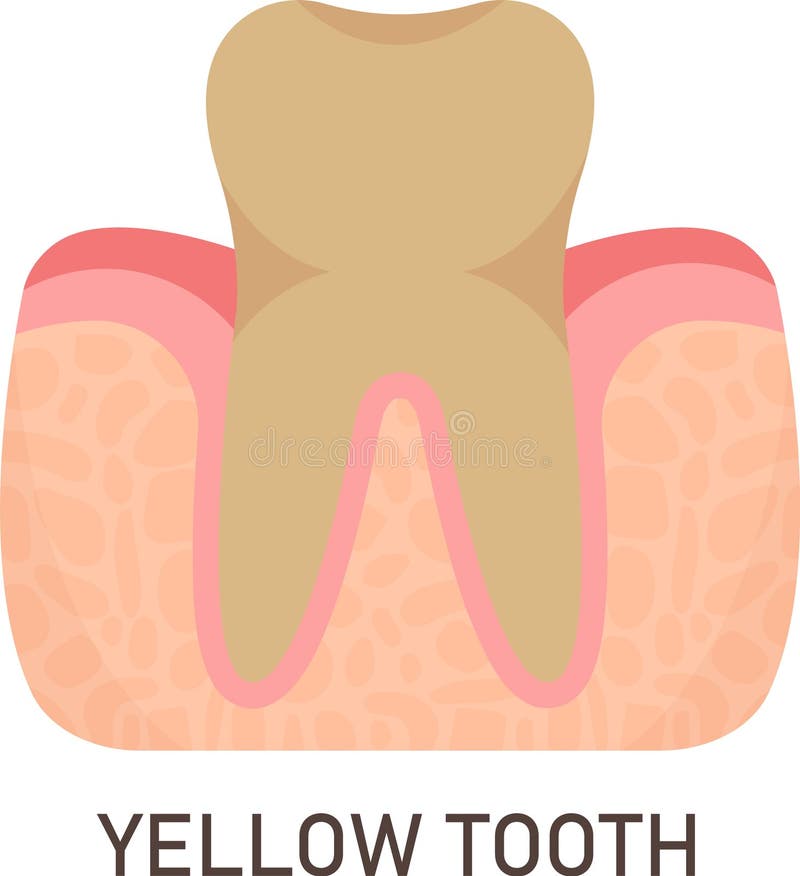Yellow Tooth Problem stock vector. Illustration of hygiene - 285677536