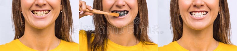Yellow and White Teeth before and after Brushing Result. Black Charcoal ...