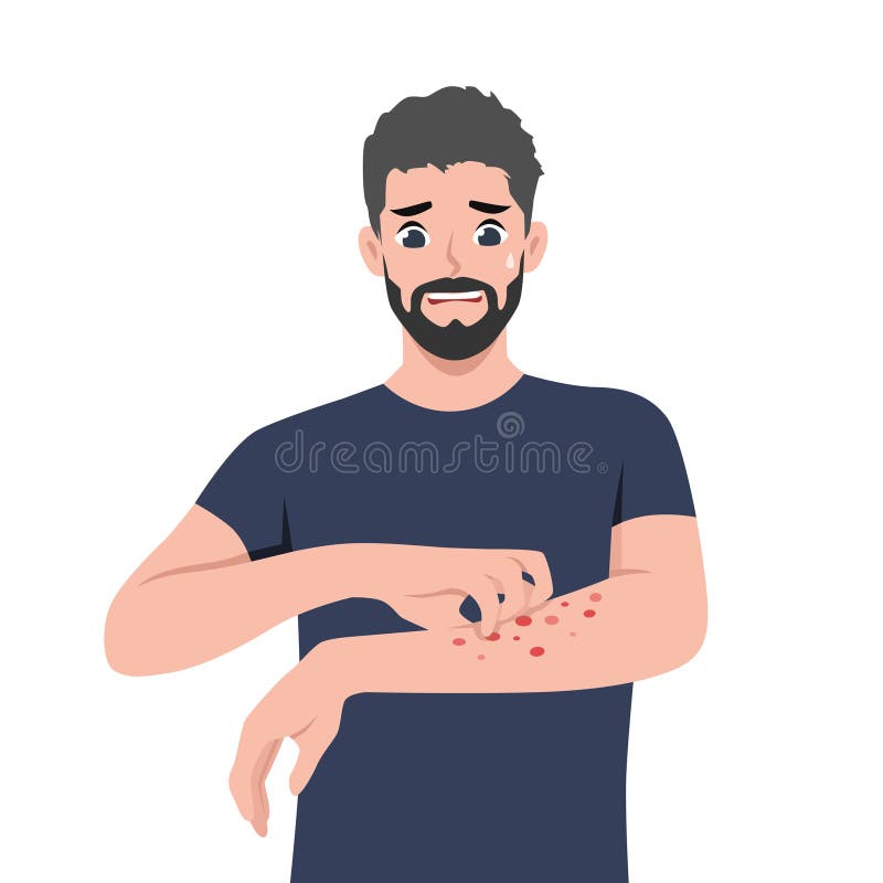 Young Bearded Man Scratching Hand and Arm. Man Suffering from Strong ... Young Bearded Man Scratching Hand and Arm. Man Suffering from Strong ...