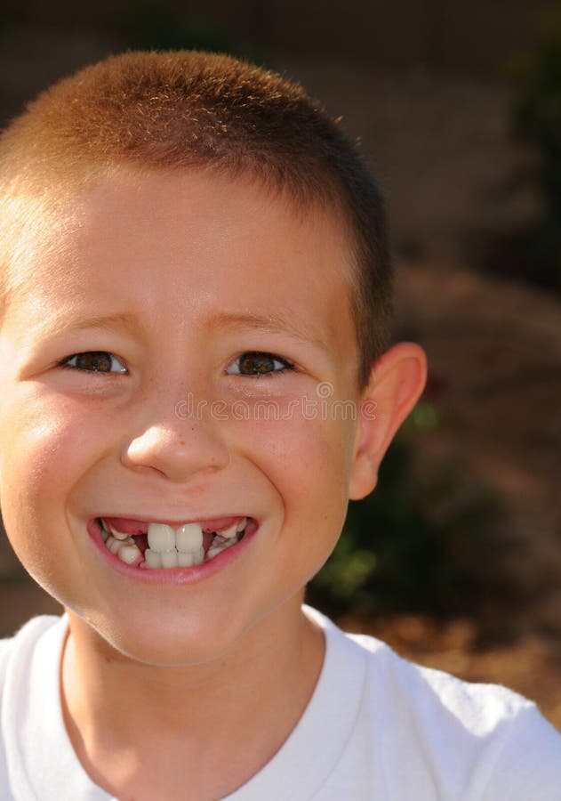 I Lost a Tooth! stock photo. Image of teeth, puerto, male - 118048