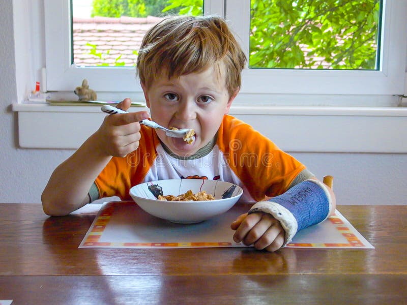 Young Boy with Arm in Cast Has Stock Photo - Image of happy, table ...