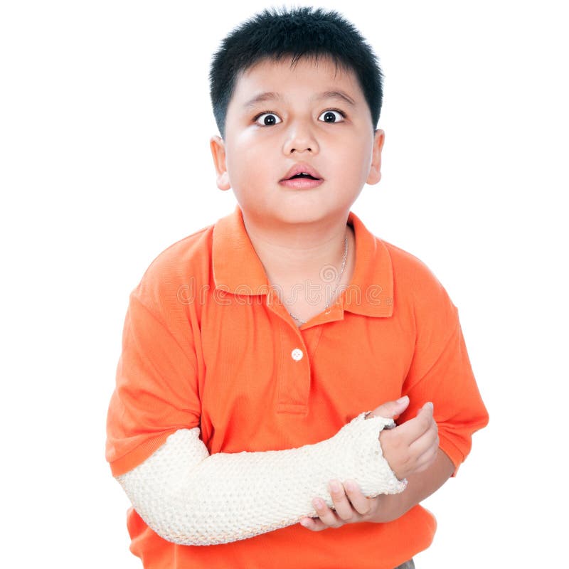 Young Boy with Broken Arm in Plaster Cast Stock Photo - Image of young ...