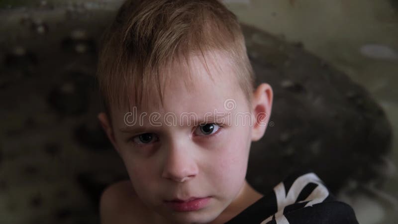 Crying Child Patient during Examination of Nose Stock Video - Video of ...