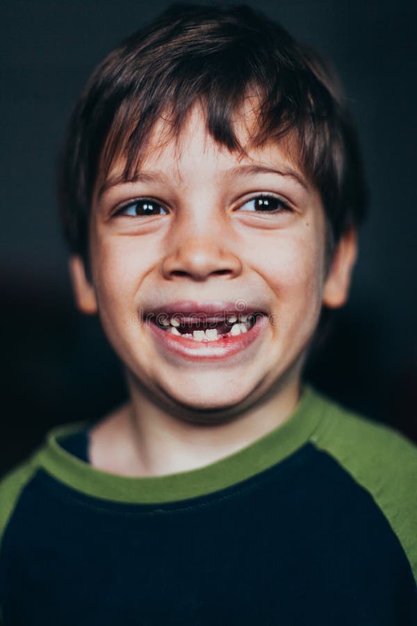 Young Boy Grinning with Missing Teeth Stock Image - Image of brunette ...